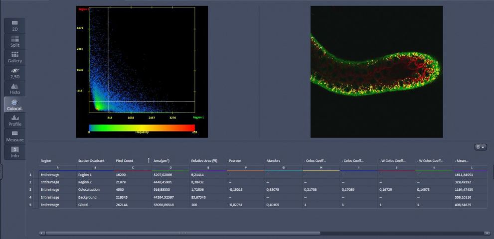 Logiciel Zen Core Zeiss - Logiciel de Microscopie Zeiss